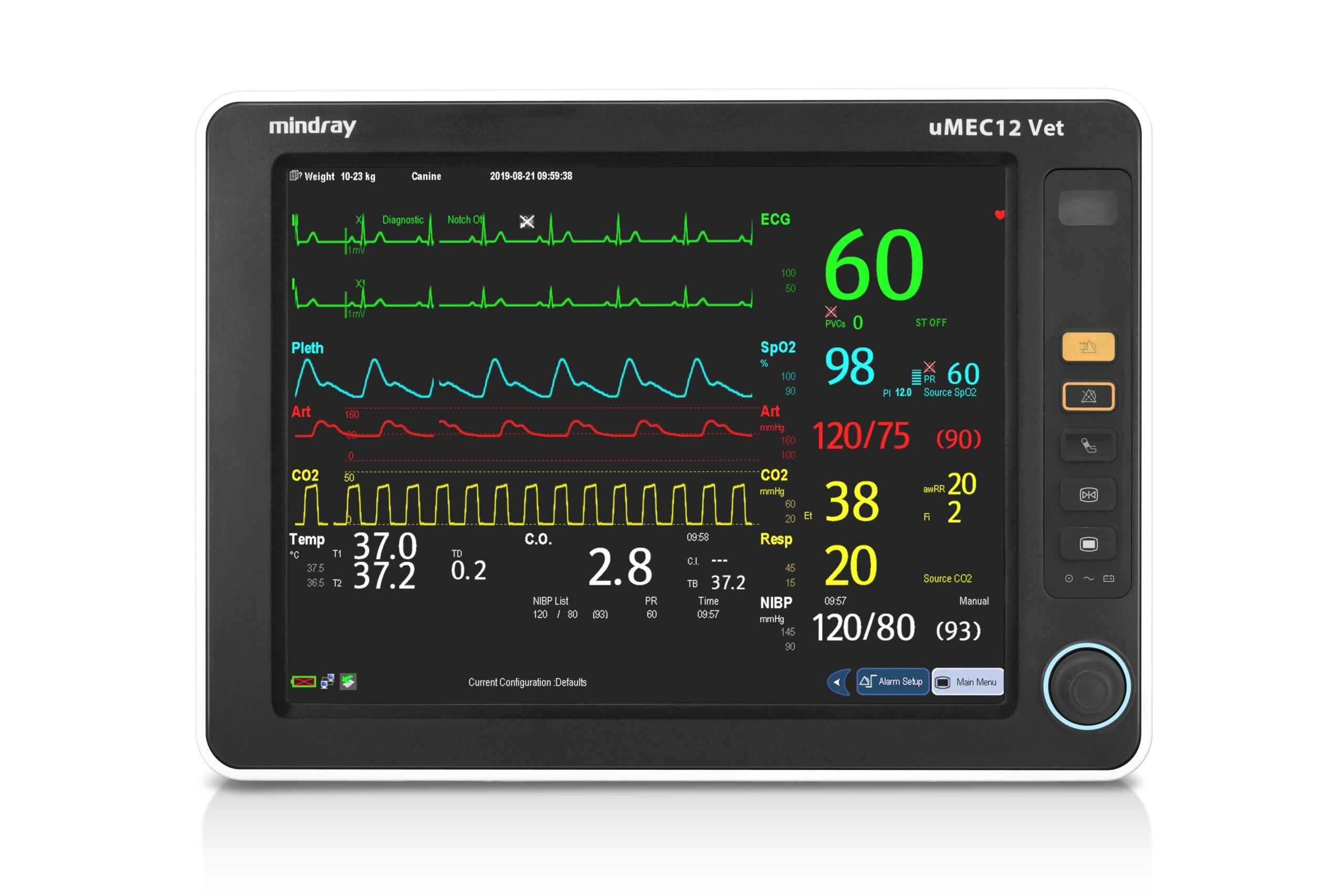 Mindray uMec 12 Anaesthesia Monitor - VAS Int
